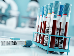 Why don’t you use intraoperative PTH (ioPTH)?